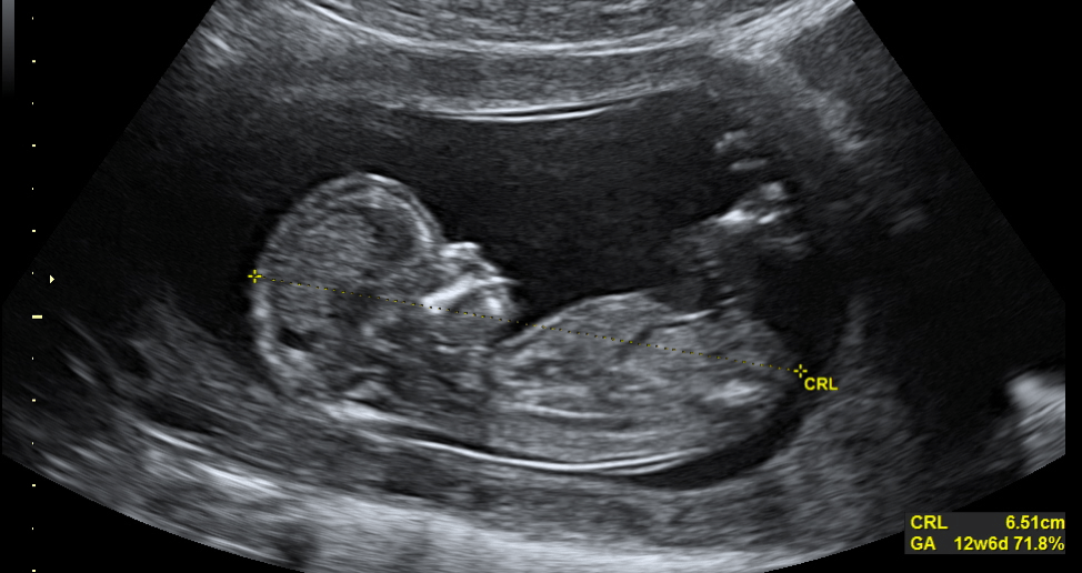 #ThanksScience: The Power of Squeezing Rocks – Science Buffs